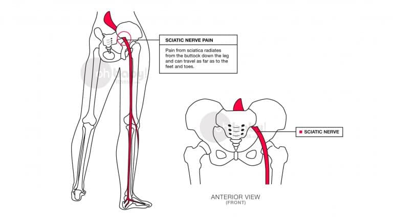 What is the Sciatic Nerve? | Days To Fitness